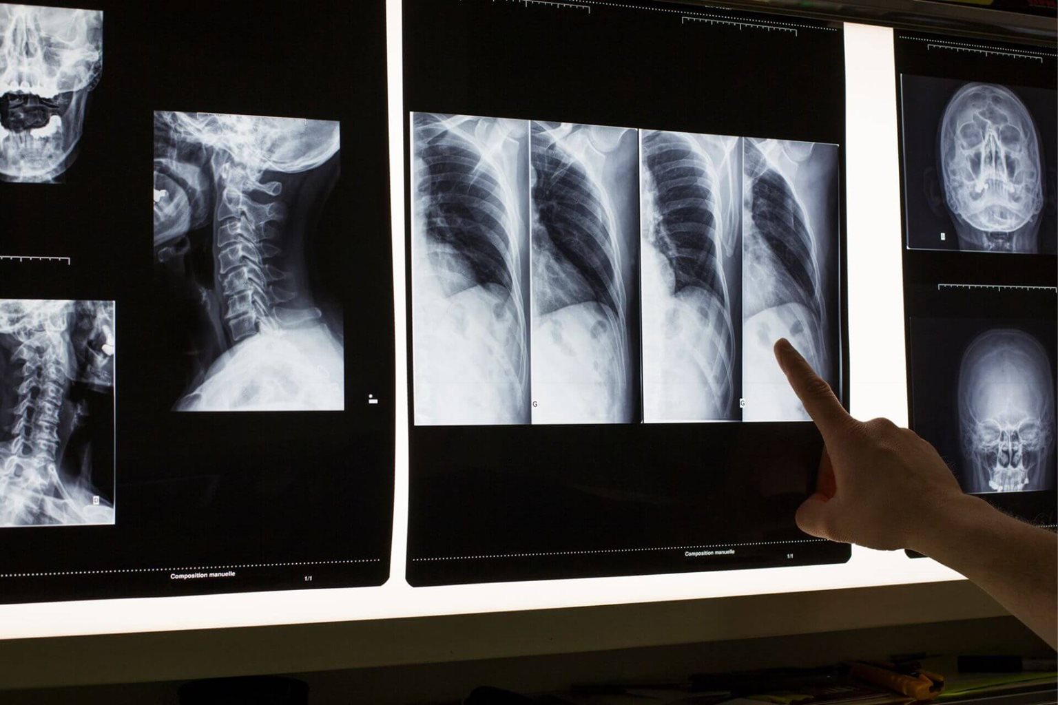 Medscan | Medical scans Barangaroo | Barangaroo